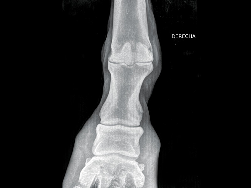 Anatomía De La Rodilla Del Caballo Huesos D Miembro